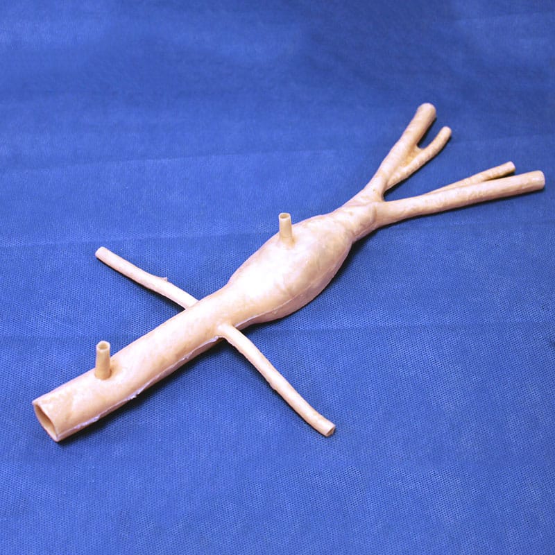 Abdominal Aortic Aneurysm Model – LifeLike BioTissue