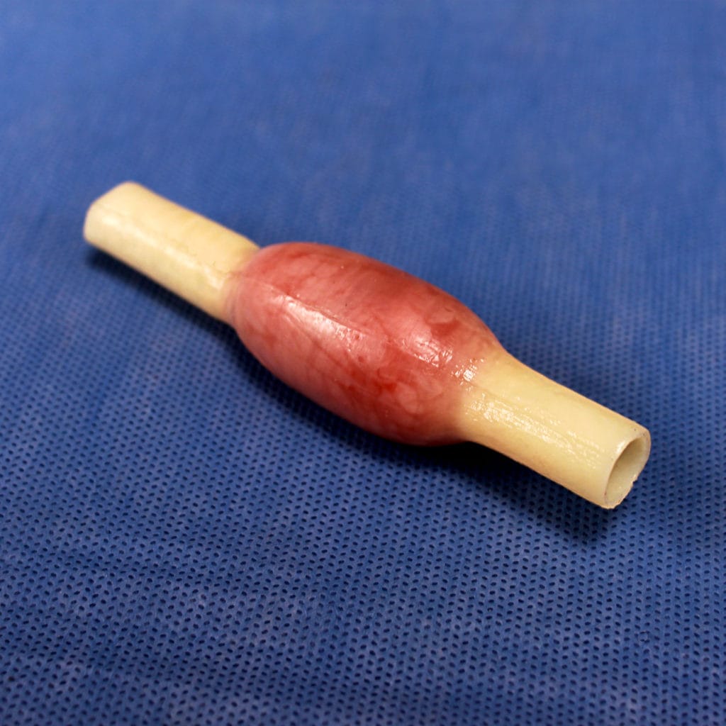 Ectopic Pregnancy Model Lifelike Biotissue 7565