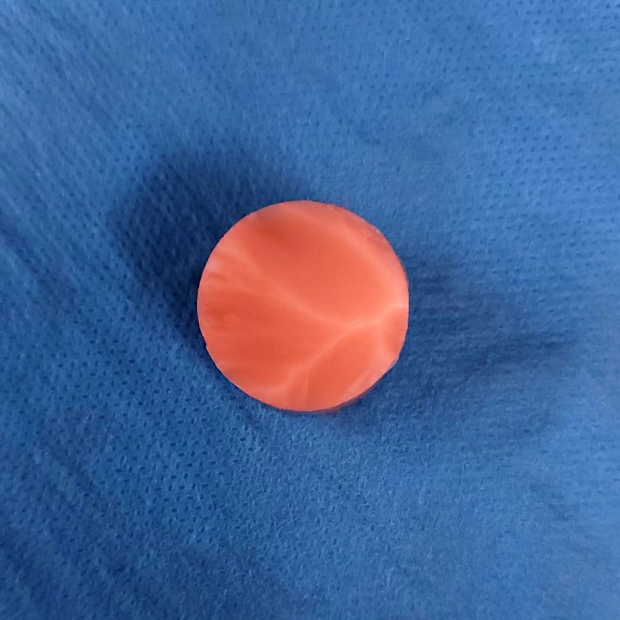 Cervix Disc Biopsy Model – LifeLike BioTissue